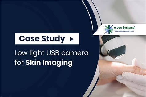 Dermatology Cameras Case Study