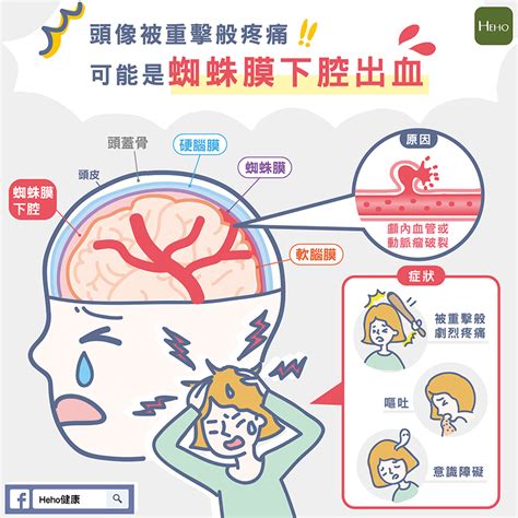 頭部劇烈疼痛可能是蜘蛛膜下腔出血 Heho健康