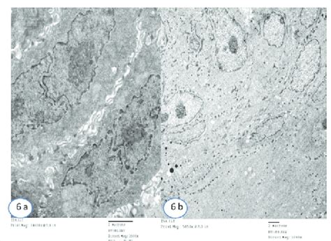Electron Micrograph Of Ovxp Group Showing A Upper Layers Of Prickle