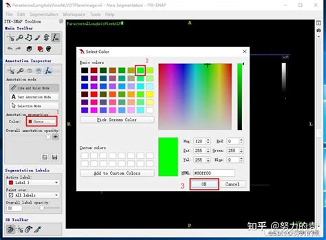 图像分割 Itk Snap分割标注（点坐标） 知乎