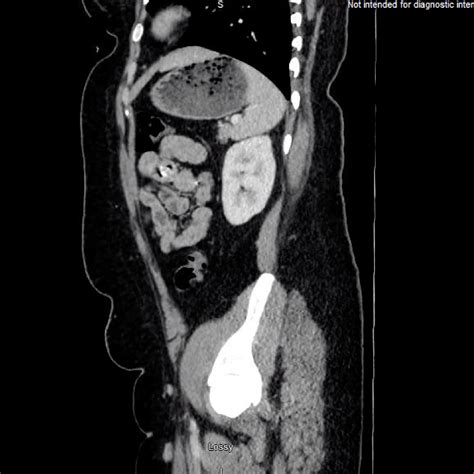 Gross Anatomy Glossary Stomach Imaging Ditki Medical Biological