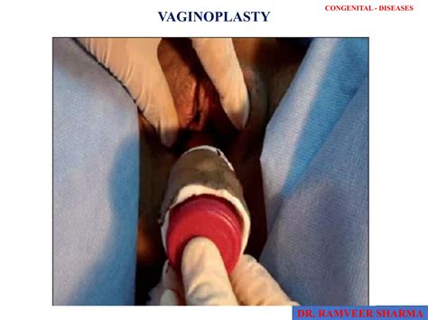 22 Congenital Deformitiespdf