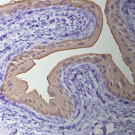 Uroplakin Ib Antibody Bsa Free Nbp1 80656 Novus Biologicals