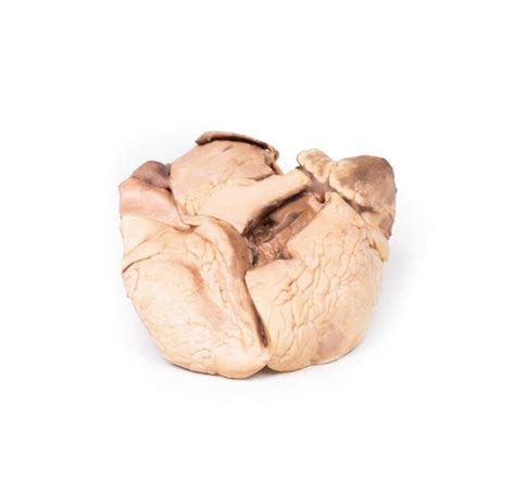 Modelo De Endocarditis Reumática Medical Factory