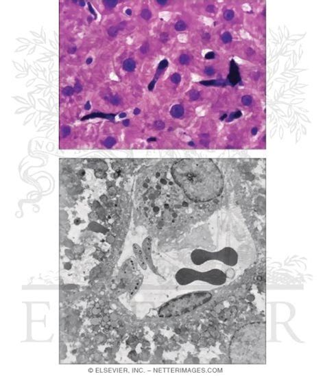 Hepatic Sinusoid