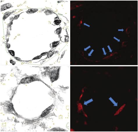 The Light Left And Fluorescence Right Microscopic View Of Two
