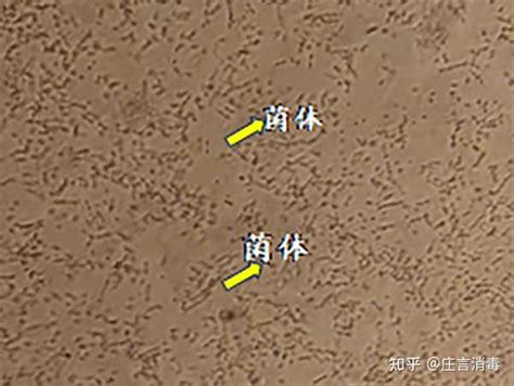 你的细胞是被什么污染了？全面介绍细胞污染有哪些种类 知乎