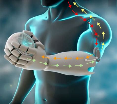 Garrett Hurley On Linkedin Robotics Computing Prosthetics
