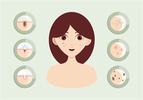 Pimple Illustration 161307 Vector Art At Vecteezy