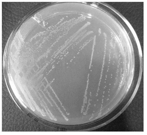 Enterococcus Faecalis Eureka Patsnap