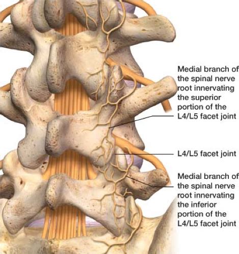 Facet Joint Procedures Facet Joint Injections Medial Branch Blocks