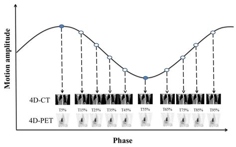 The Respiratory Cycle Was Divided Into 10 Phases Based On Motion