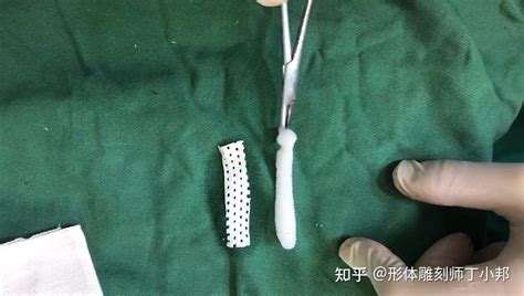 隆鼻假体透光、皮肤发红，怎样修复？丁小邦隆鼻修复科普问答 知乎