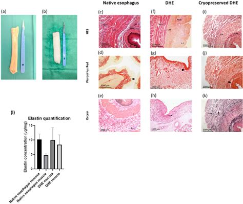 Dna Quantification Before And After Dnase Incubation Measured By Download Scientific Diagram