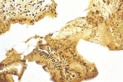 Warthin Starry Kit Biognost