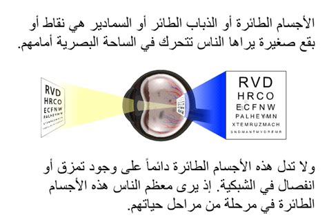 انفصال الشبكية