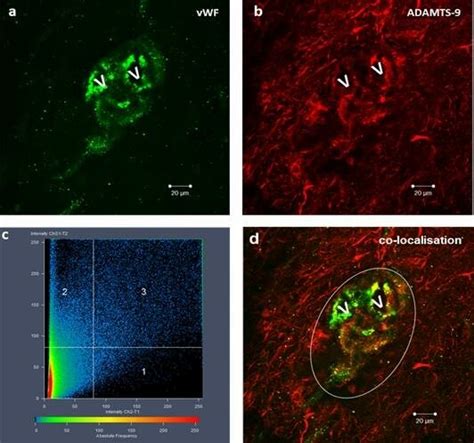 Dual Label Immunofluorescence Of Adamts 9 And Vwf In Ms Al Brain Tissue