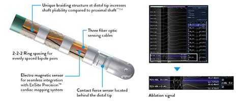 About The Tacticath Contact Force Ablation Catheter Se