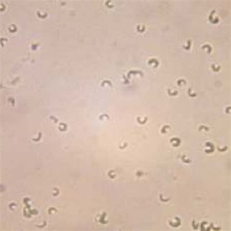 Growth Rate μ Of P Subcapitata 72 H After Ecotoxicological Bioassay