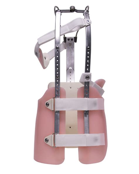 Scoliosis Milwaukee Brace Online