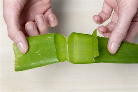20 Sunburn Home Remedies Unusually Easy To Apply On The Skin