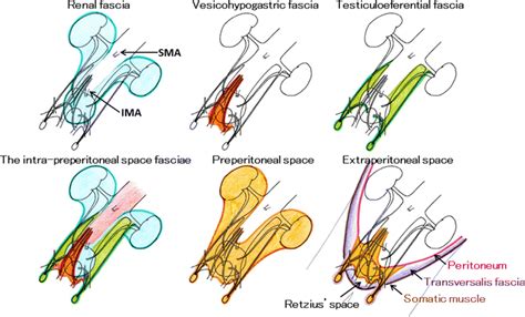 Preperitoneal Space Which Is Local Cavity Download Scientific Diagram