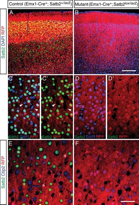 Satb2 Regulates The Differentiation Of Both Callosal And Subcerebral Projection Neurons In The