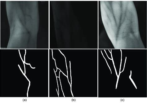 Some Samples Of The Dataset A Arm Images Under A Natural Light Download Scientific