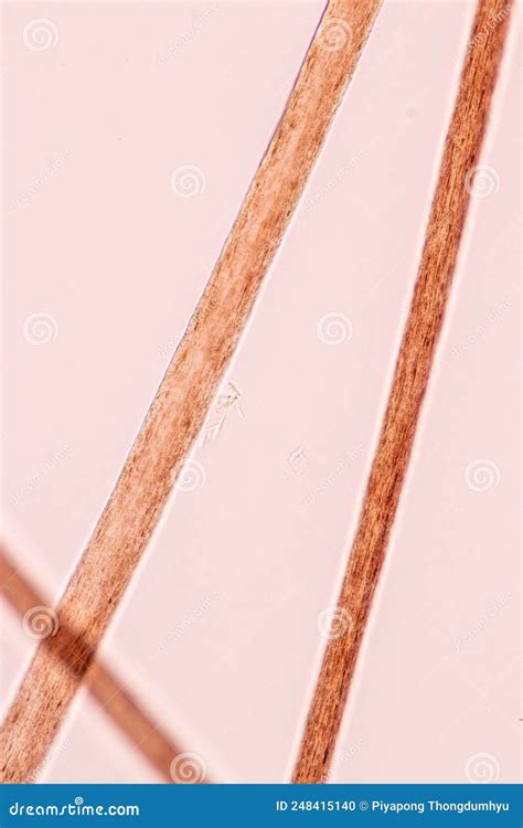 Scalp And Hair Follicles Of Human Under The Microscope Stock Photo Image Of Medical Cuticle