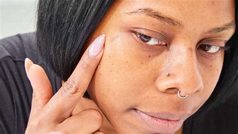 Clear Dark Spots On Face