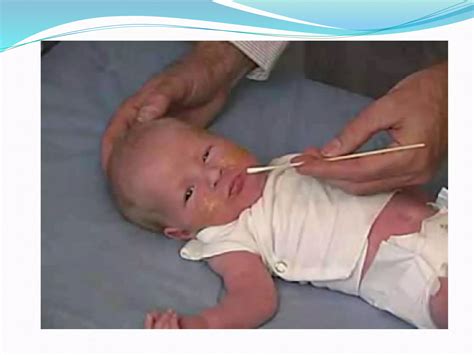 Neonatal Reflexes By Baneet Pptx