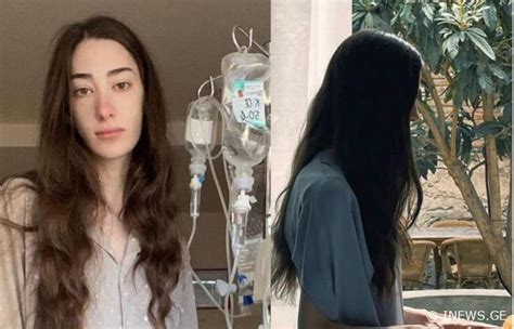 სასწაული ისტორია ქართველი გოგონა რომელმაც ანორექსია ასე დაამარცხდა ვერასოდეს ვიფიქრებდი თუ