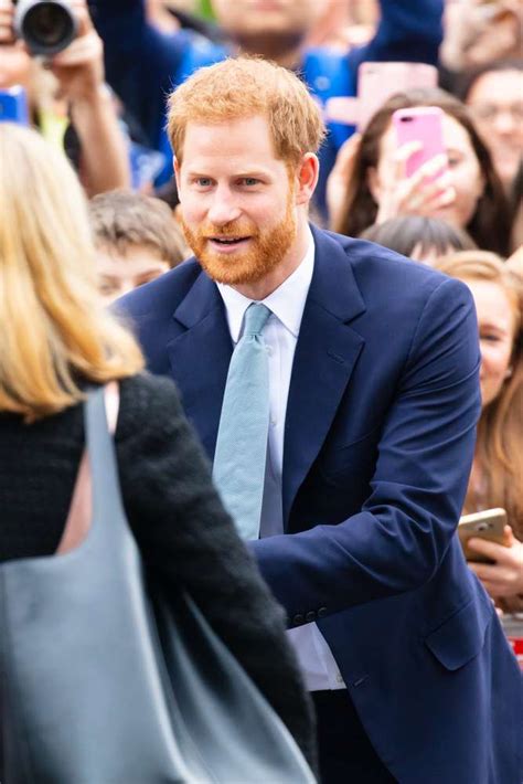 Has Prince Harry Had A Hair Transplant Longevita