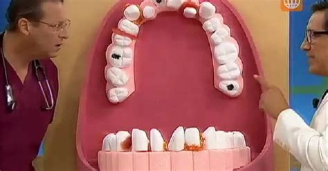 ¿por Qué Salen Los Dientes Chuecos Y A Qué Edad Debemos Corregirlos