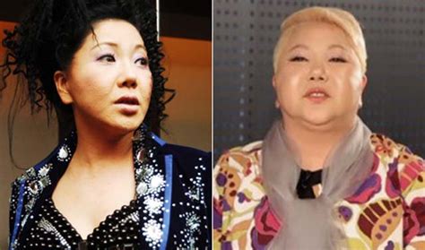 이은하 괴롭힌 쿠싱증후군 예방과 치료법은 연예 기사 더팩트