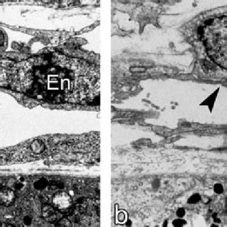 A B Transmission Electron Micrographs At The Same Magnification Of