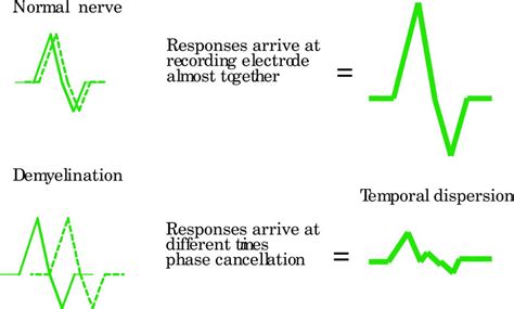Nerve Conduction Study Emg Nerve Conduction Study And Side Effects