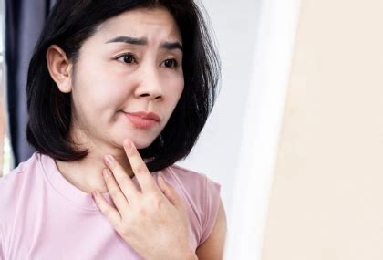 眼歪嘴斜嚇以為中風醫揪5異狀是顏面神經痙攣 眼皮狂跳別輕忽