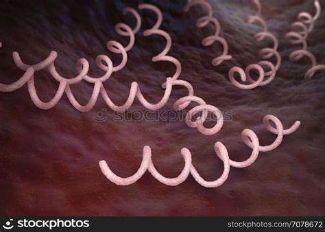 Syphilis Bacteria Syphilis Is A Sexually Transmitted Infection Caused