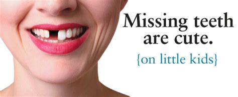 3 Tooth Replacement Options To Consider