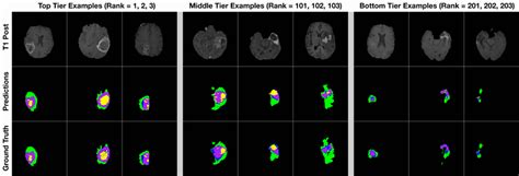 Representative Segmented Slices Results Of The Algorithm Are Given For
