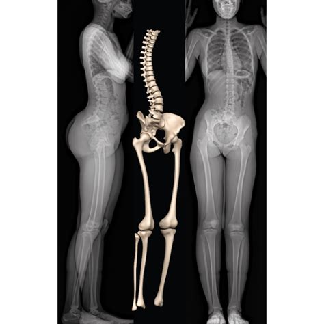 Eos System Eos Imaging