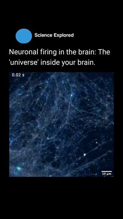 Dr Halit Yaşar Linkedin‘de Gökyüzündeki Yıldızlar Gibi Görünen Beyin Hücreleri