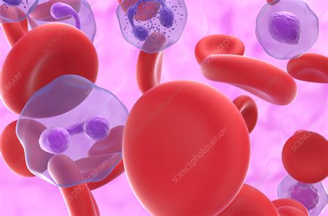 Polycythaemia Vera Blood Cancer Illustration Stock Image F0430245