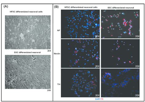 Differentiation Of Sscs And Hfscs Cells Into Neuronal Cells And Their Download Scientific