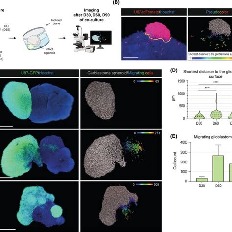 Characterization Of Cerebral Organoids And U87 Glioblastoma Cell Line