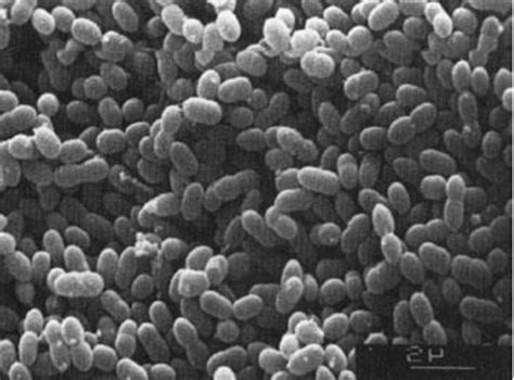 5 Morphologie En Microscopie électronique De Lactococcus Lactis