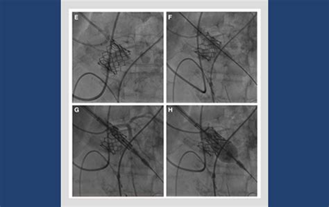 Unicorn Y Tavr Ancissste