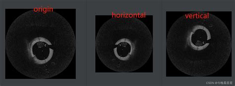 Pytroch Torchvision Torchvision Csdn