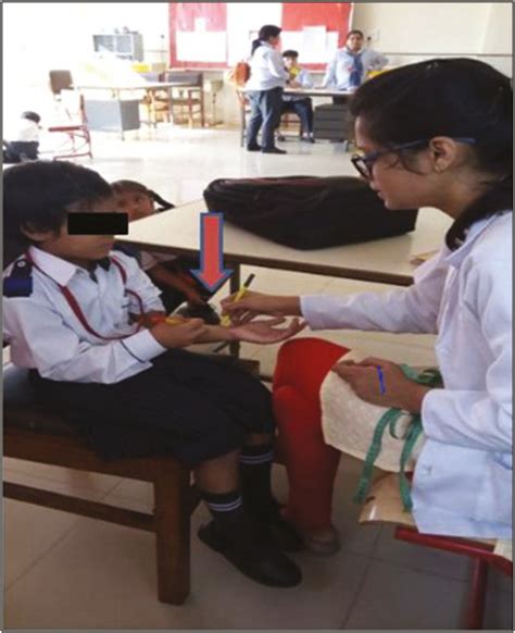 Normative Reference Value For Tactile Localization Acuity Among School